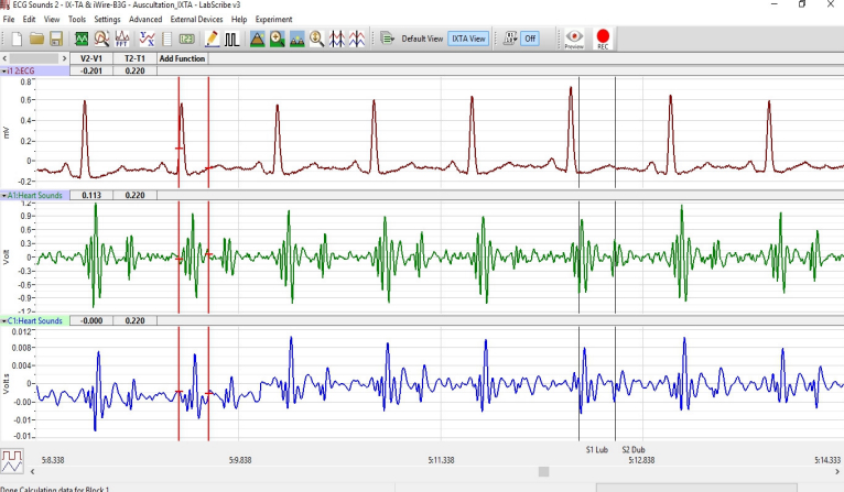 Electronic Stethoscope - Heart Sound - 고투바이오 GoTooBIO
